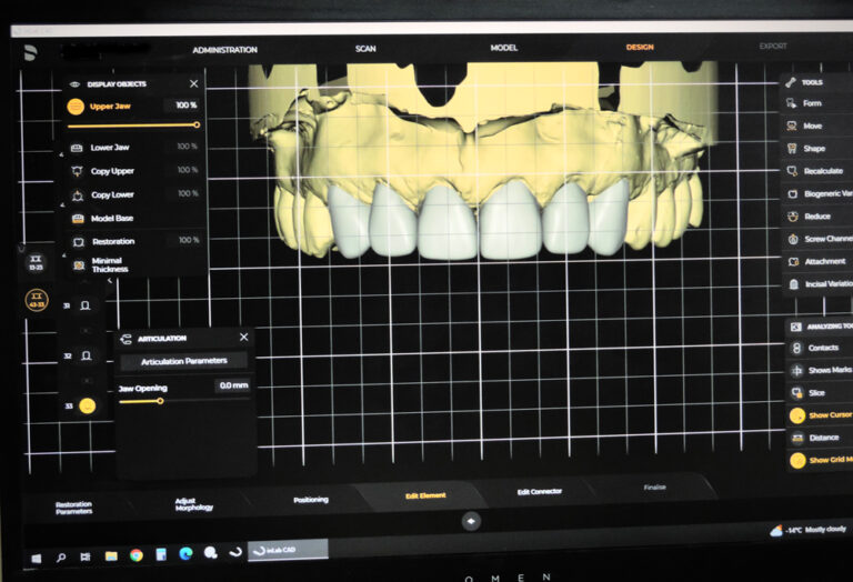 Digital Diagnostic Wax/Mock Up - Cera-Tech Dental Lab